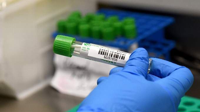 Active Covid case numbers fall below 750 | iomtoday.co.im